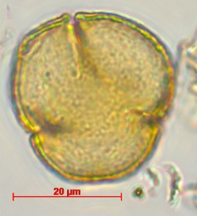 Pollen photos NE Siberia - pimdeklerk-palynology.eu