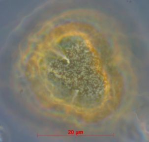 Pollen photos NE Siberia - pimdeklerk-palynology.eu