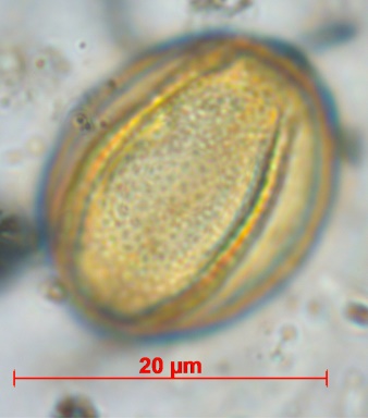 Pollen photos NE Siberia - pimdeklerk-palynology.eu