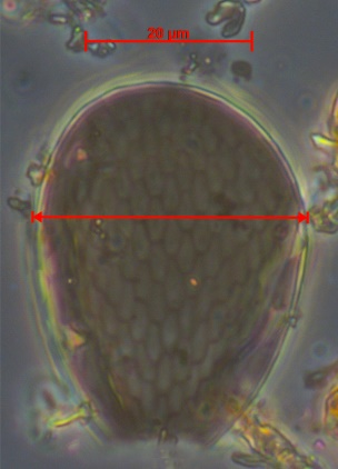 Pollen photos NE Siberia - pimdeklerk-palynology.eu