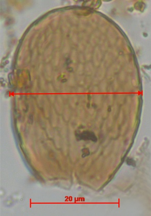 Pollen photos NE Siberia - pimdeklerk-palynology.eu